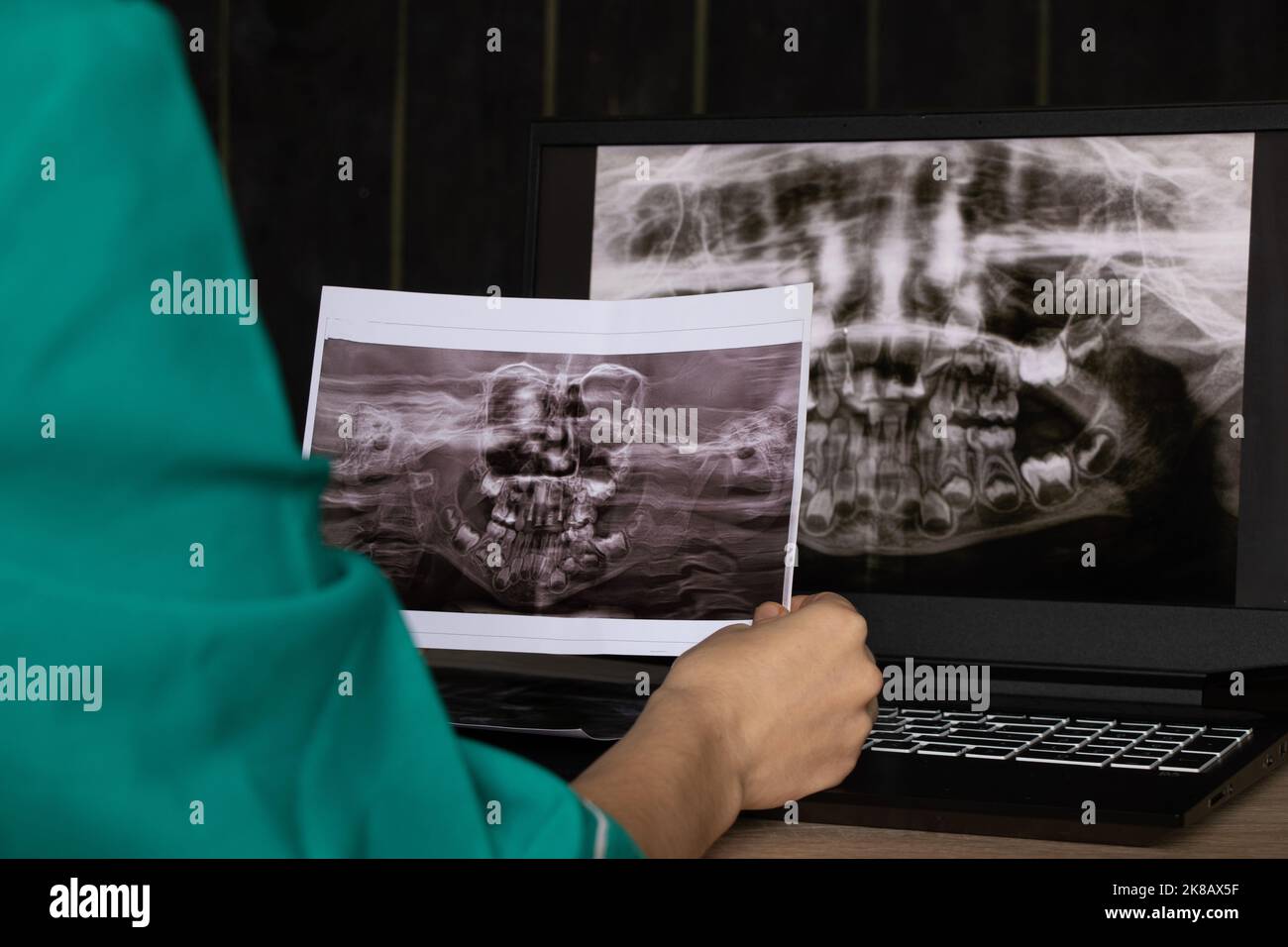 panoramic X-ray of children's teeth of two jaws, orthopantomogram of ...