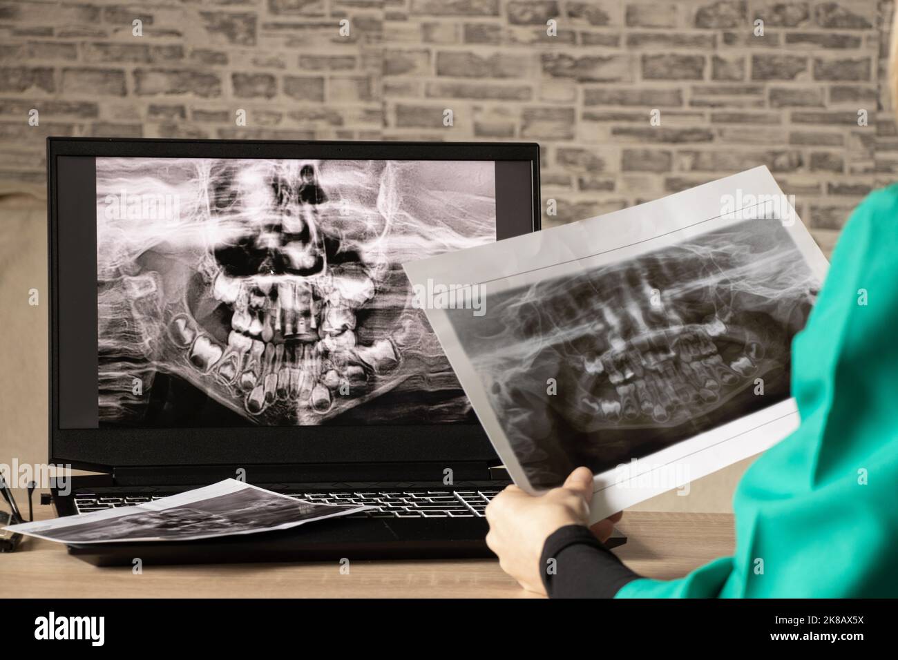 panoramic X-ray of children's teeth of two jaws, orthopantomogram of ...