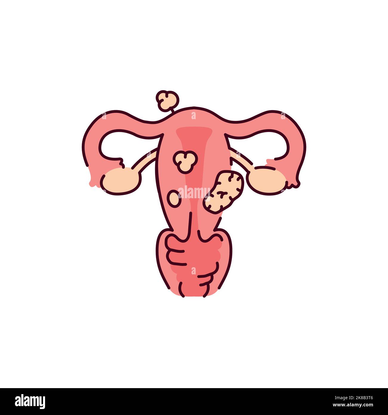 Uterine myoma color line icon. Gynecology problem Stock Vector Image ...