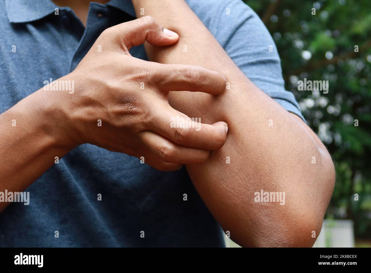 man suffering from itching skin, close up Stock Photo - Alamy