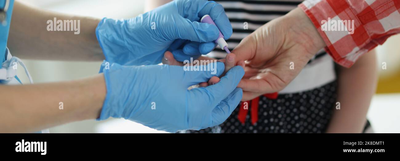 Doctor use lancet on patient finger to check blood sugar level by ...