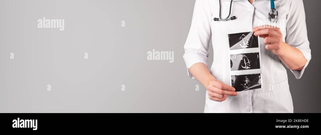 Heart ultrasound, cardiac scan, medical check-up result. Ad banner ...