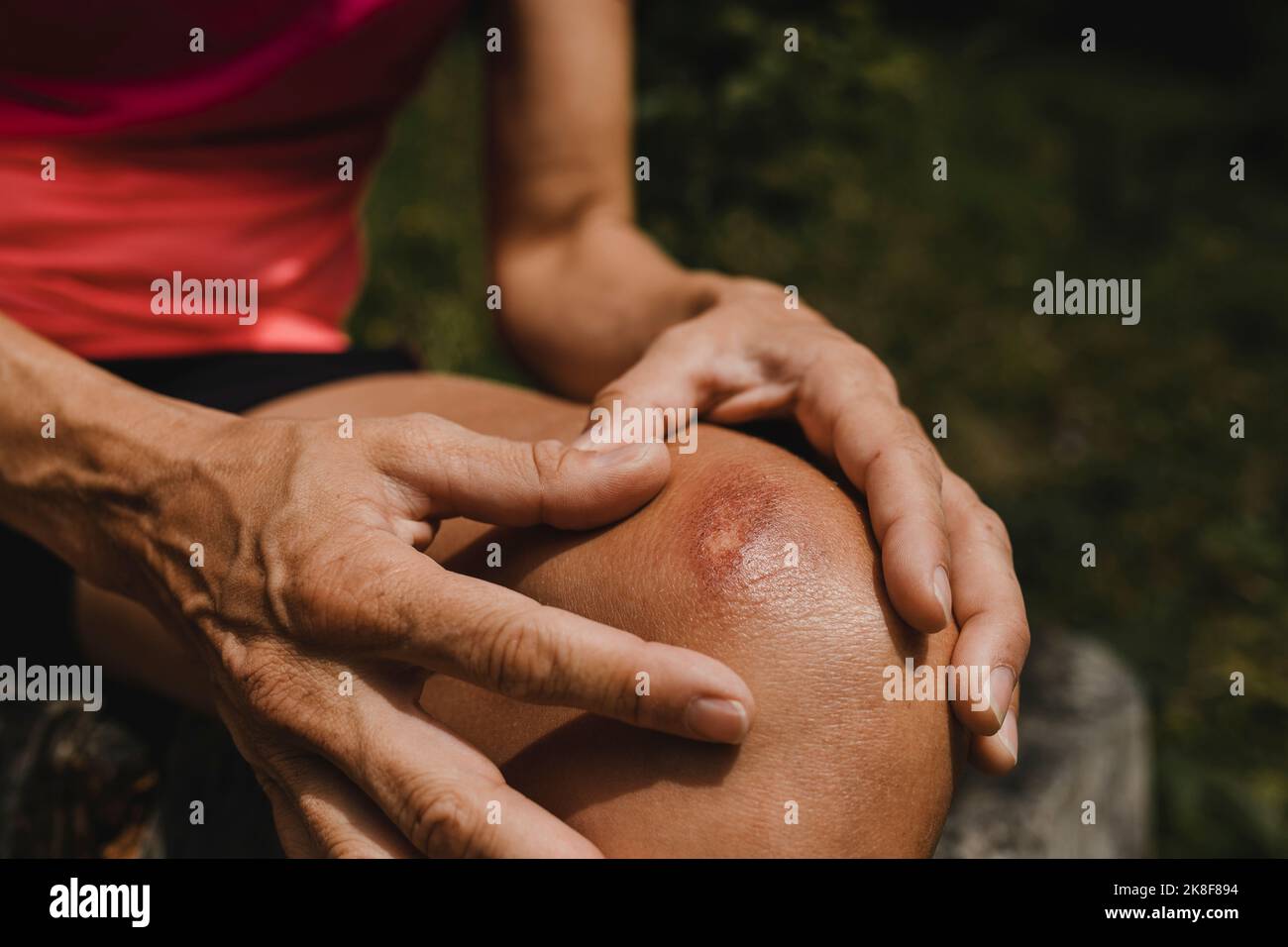 Wounded woman hi-res stock photography and images - Alamy