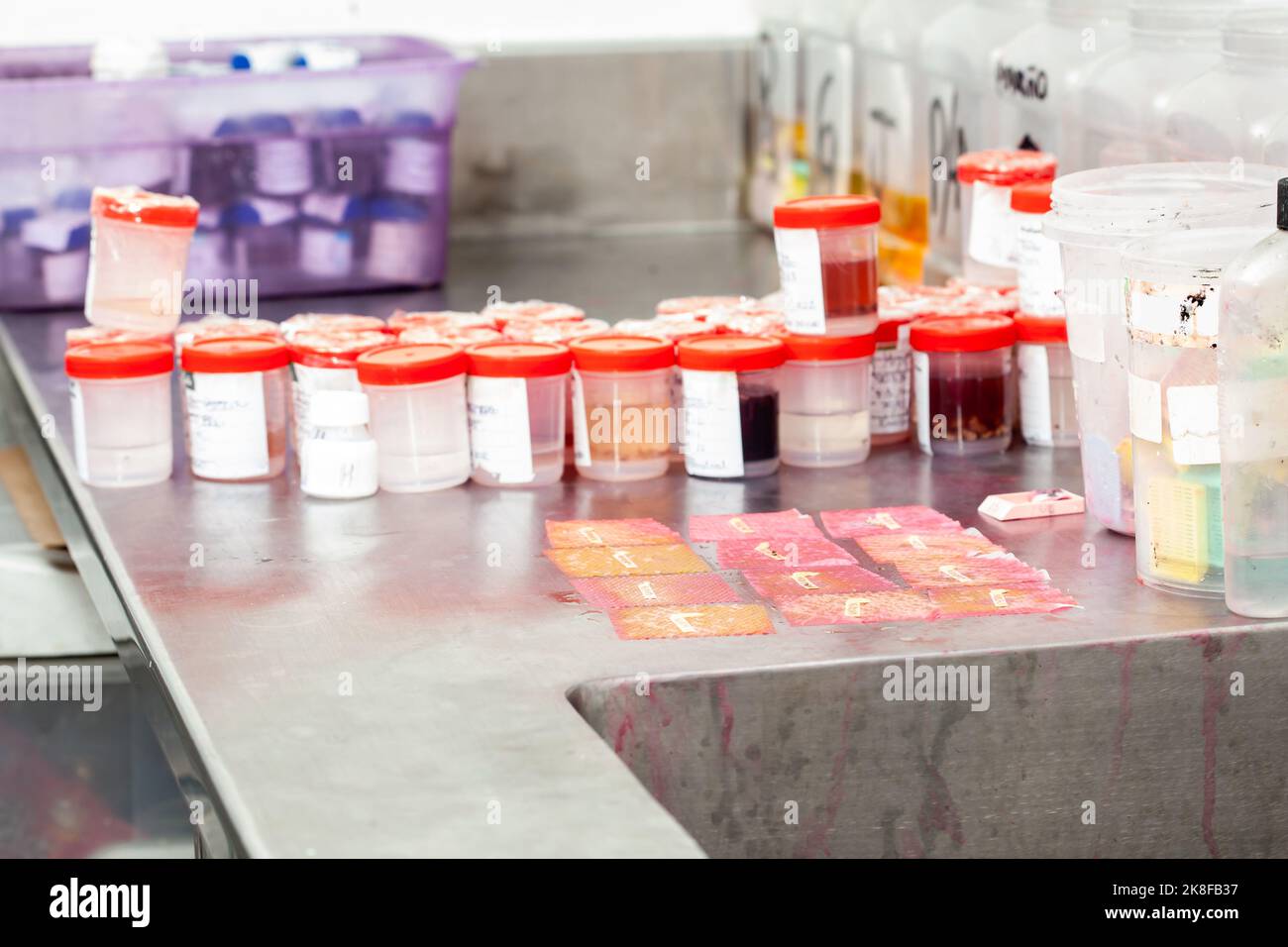 Biopsy samples being processed at the pathology laboratory to be ...