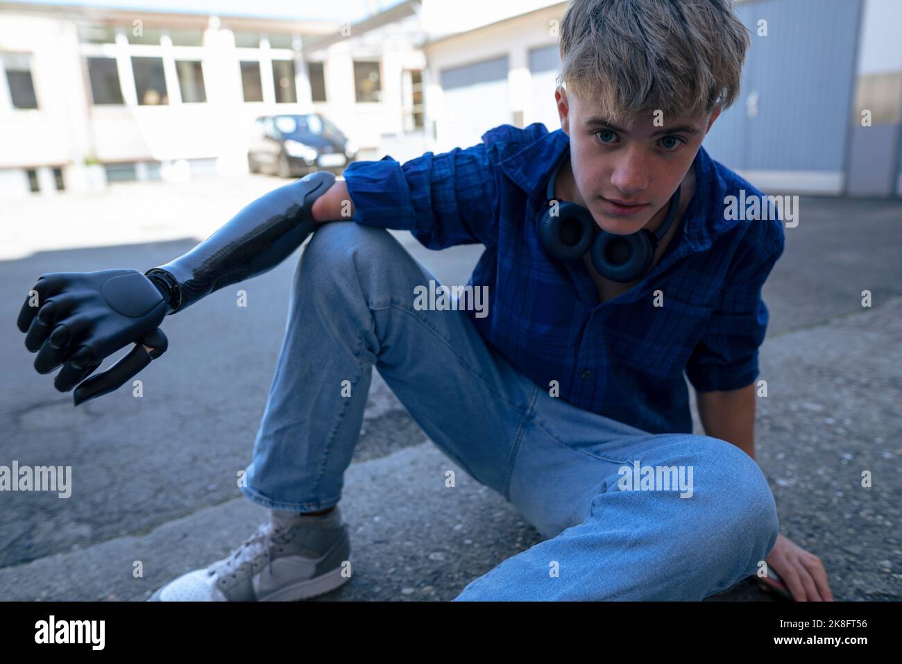 Amputated arm hi-res stock photography and images - Alamy