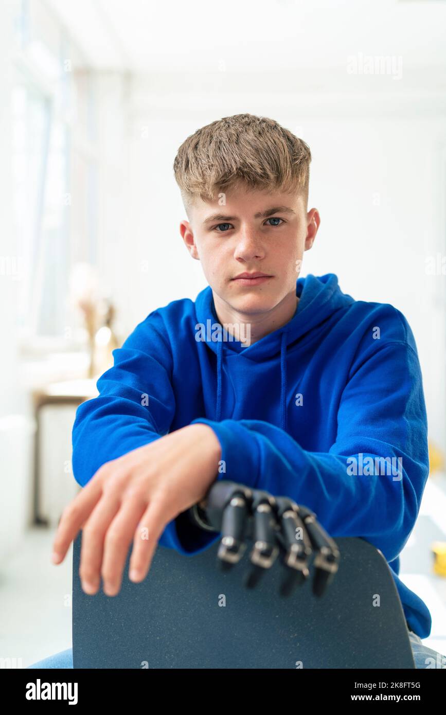 Confident teenage boy with amputated arm sitting on chair Stock Photo ...