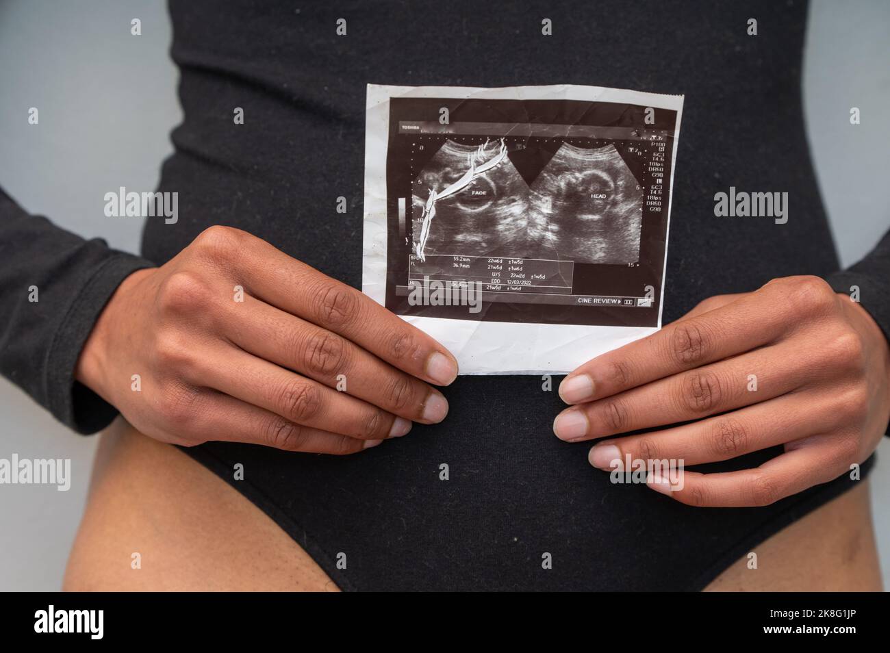 Sonogram fetus hi-res stock photography and images - Alamy