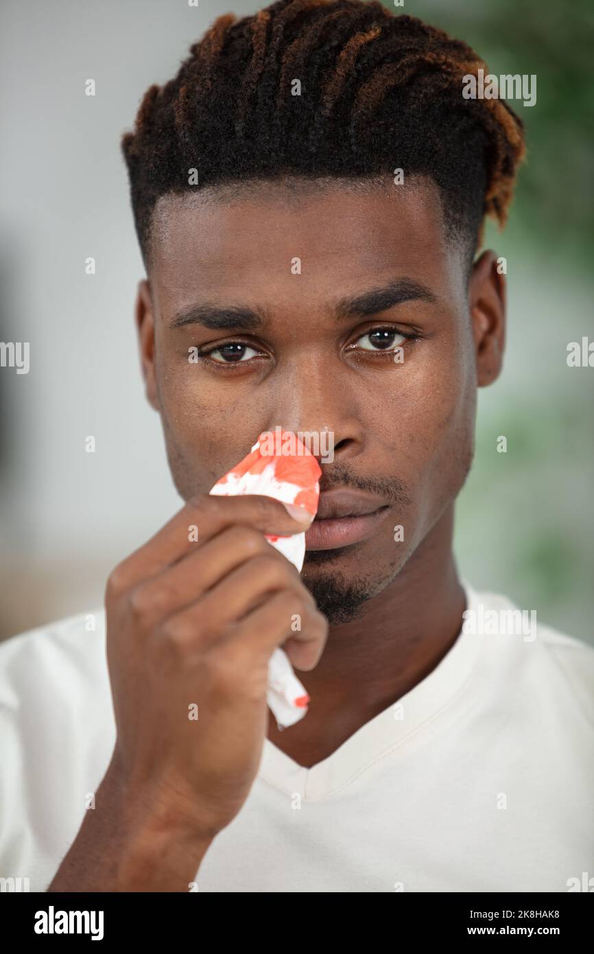 Bleeding nose hi-res stock photography and images - Alamy