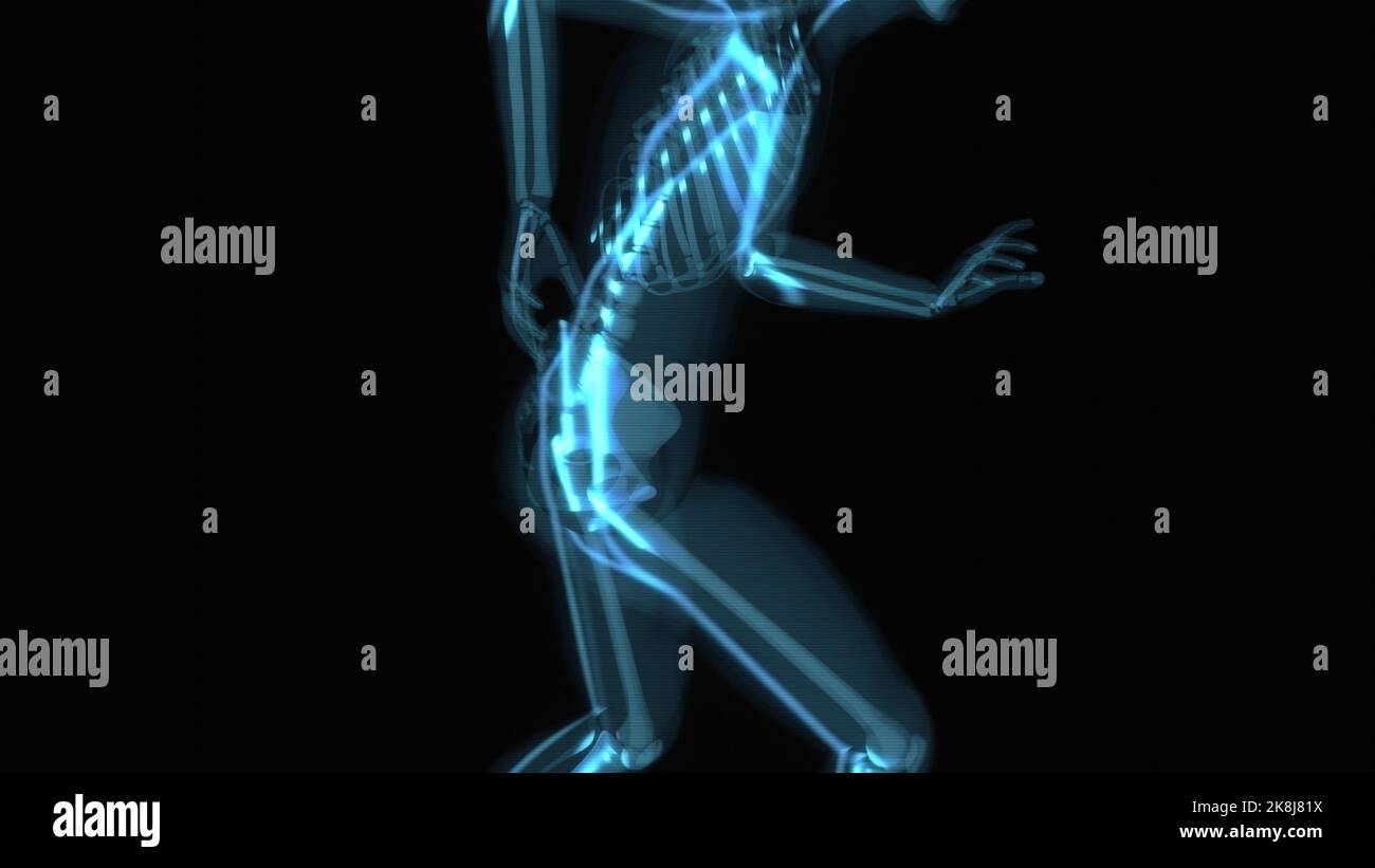 Abstract 3D motion design of backpain Stock Photo - Alamy