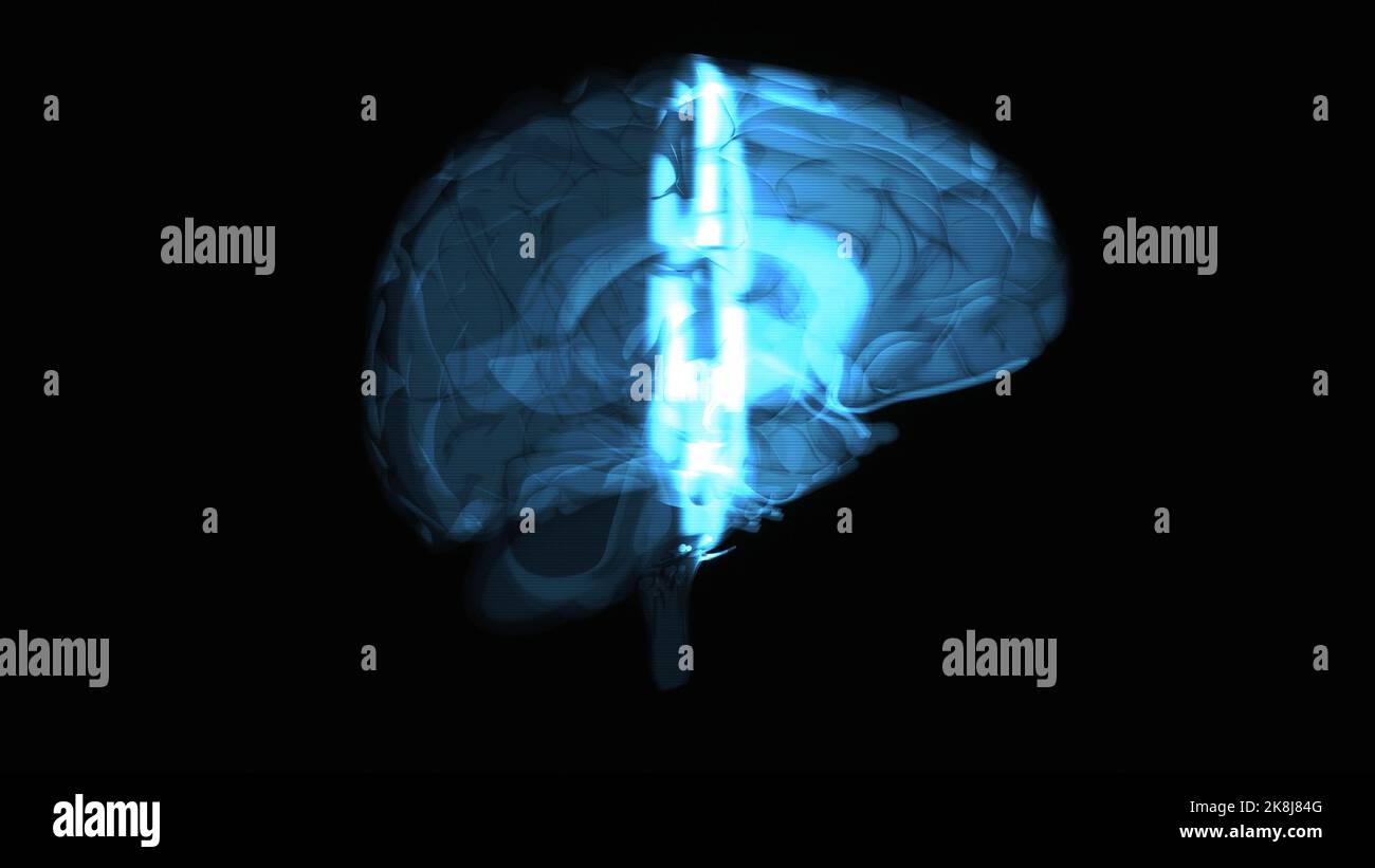 3D abstract art of a brain motion design Stock Photo - Alamy