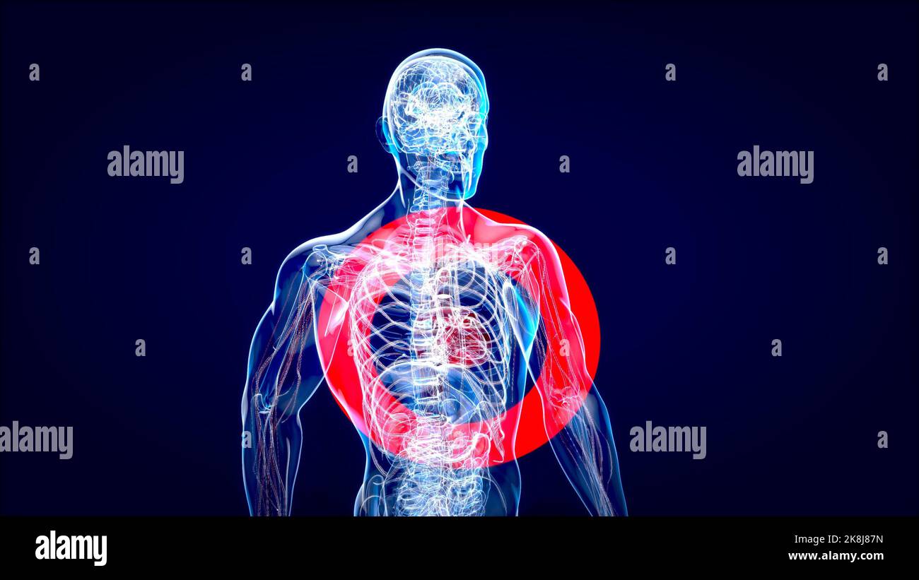 Pig heart transplant hi-res stock photography and images - Alamy