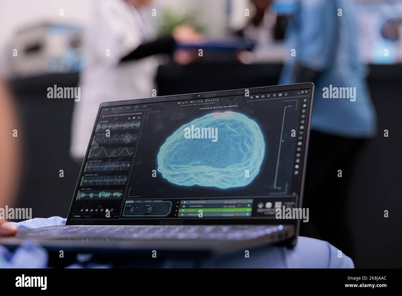 Computer screen showing patient brain analysis. Cerebral studies on ...