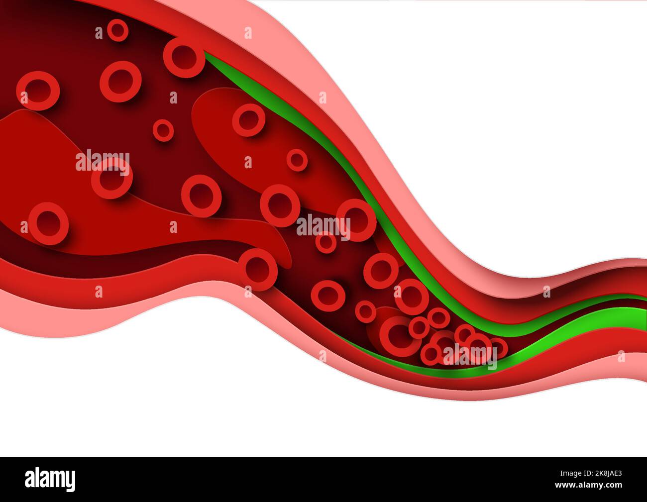 Cholesterol blood artery vessel, vein 3d anatomy Stock Vector Image ...