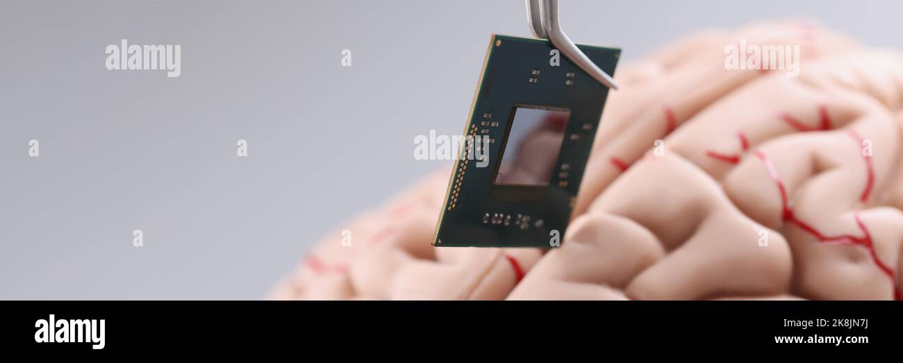 Person use tweezer tool to put tiny computer chip detail in human brain ...