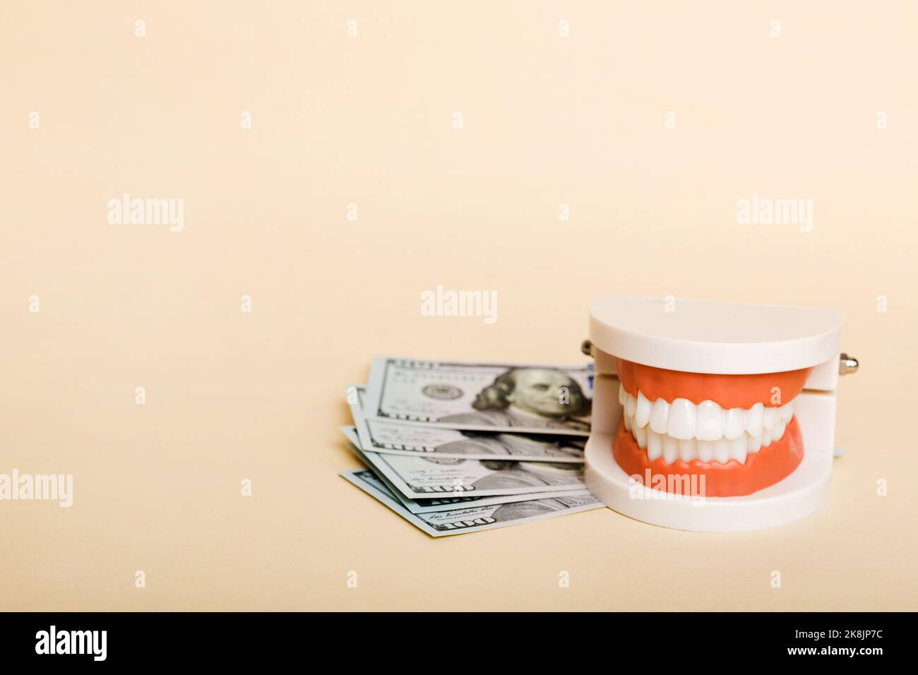 Closeup model of a human jaw with white teeth and dollar bill ...