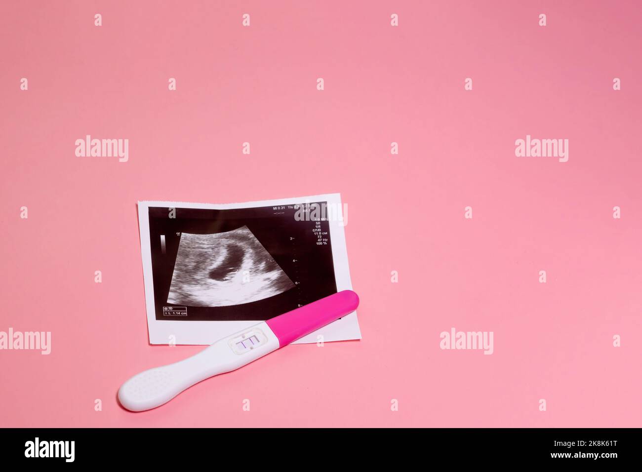 Photo of ultrasound and pregnancy test on a pastel pink background ...