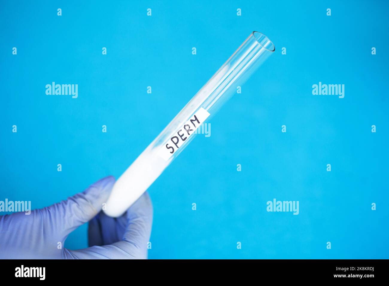 Health Sample Sperm Donor Sperm Close Up Concept Of Bank Sperm Test Tube With Sperm Stock