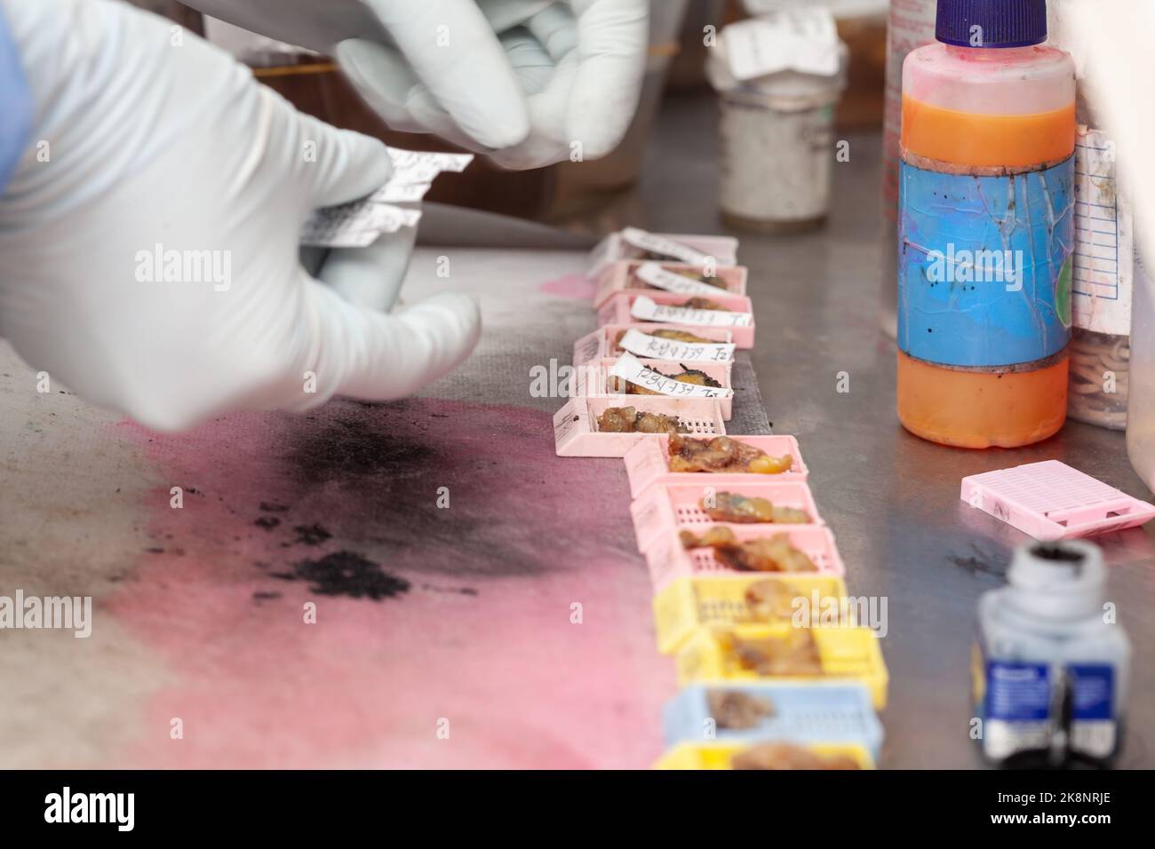 Biopsy samples being processed at the pathology laboratory to be ...