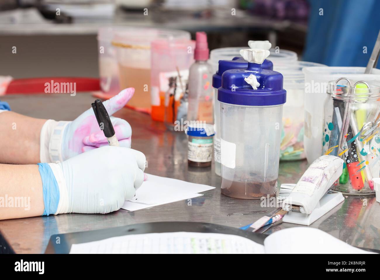 Biopsy samples being processed at the pathology laboratory to be ...