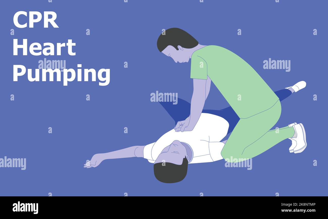 A vector illustration of a doctor giving CPR to a patient Stock Vector Image & Art - Alamy