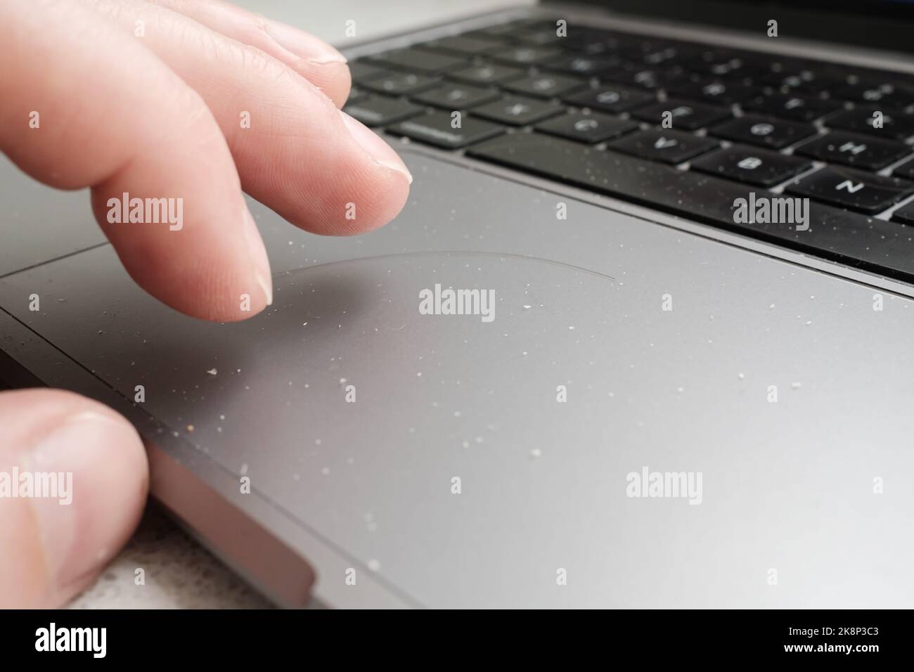 Hand is working with a laptop, which is covered with dandruff and hair ...