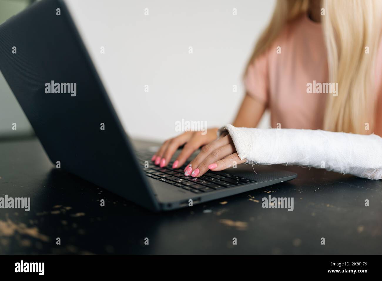 Close-up side view of unrecognizable young woman with broken hand ...