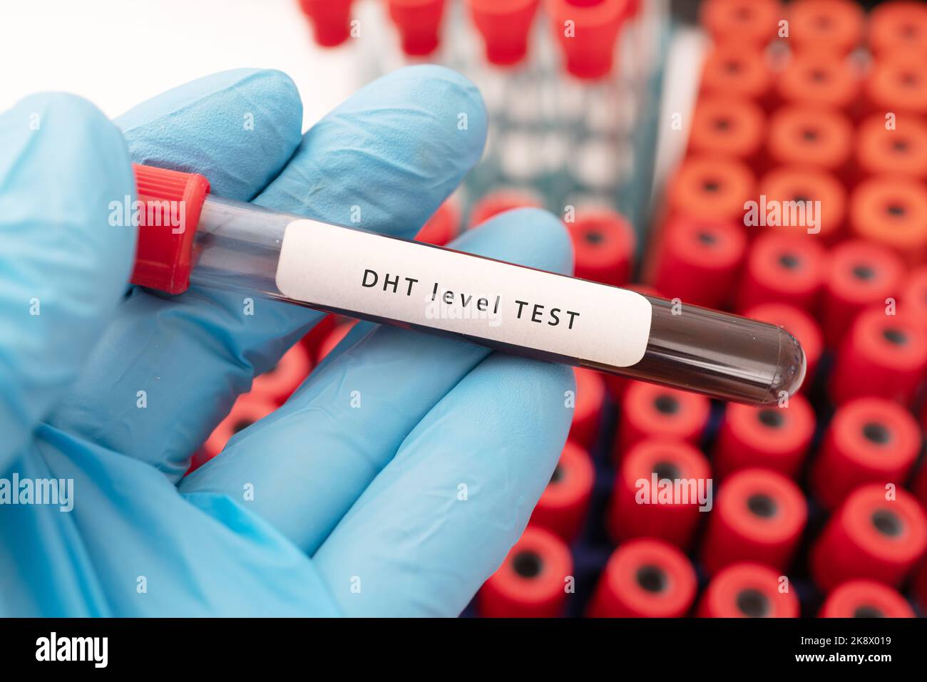 Hand holding a glass of test tube with patient's blood for testing ...
