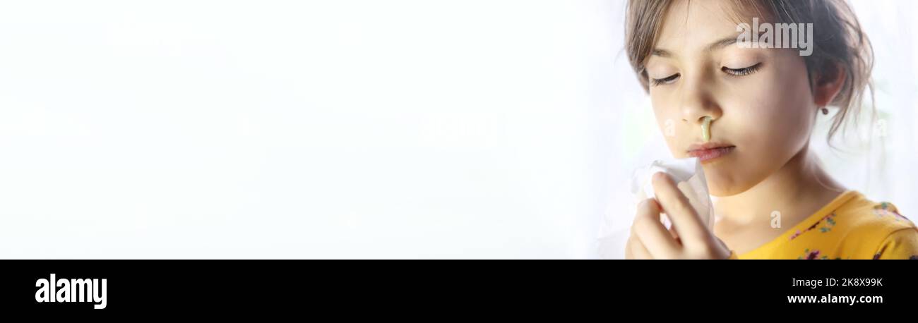 Big snot hi-res stock photography and images - Alamy