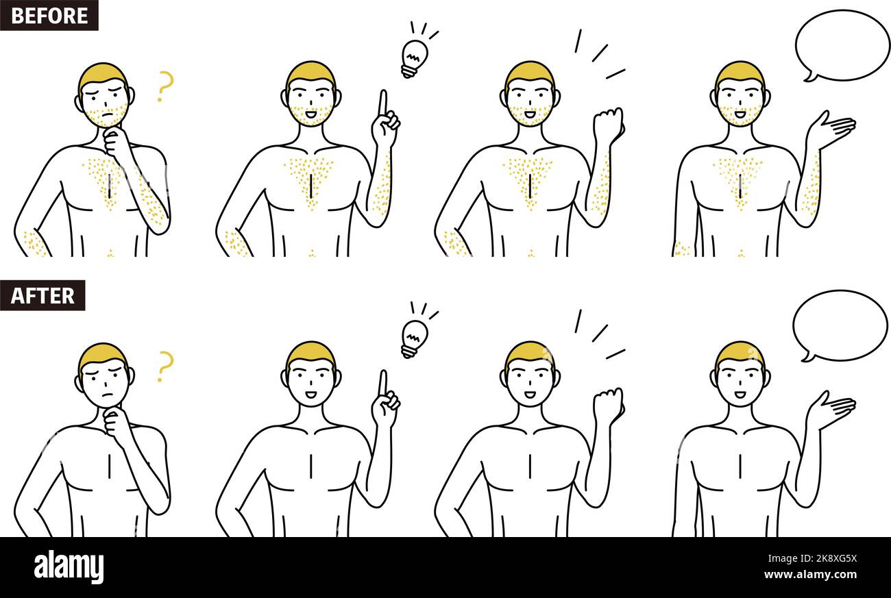 Set of line drawing poses of a man suffering from thick body hair ...
