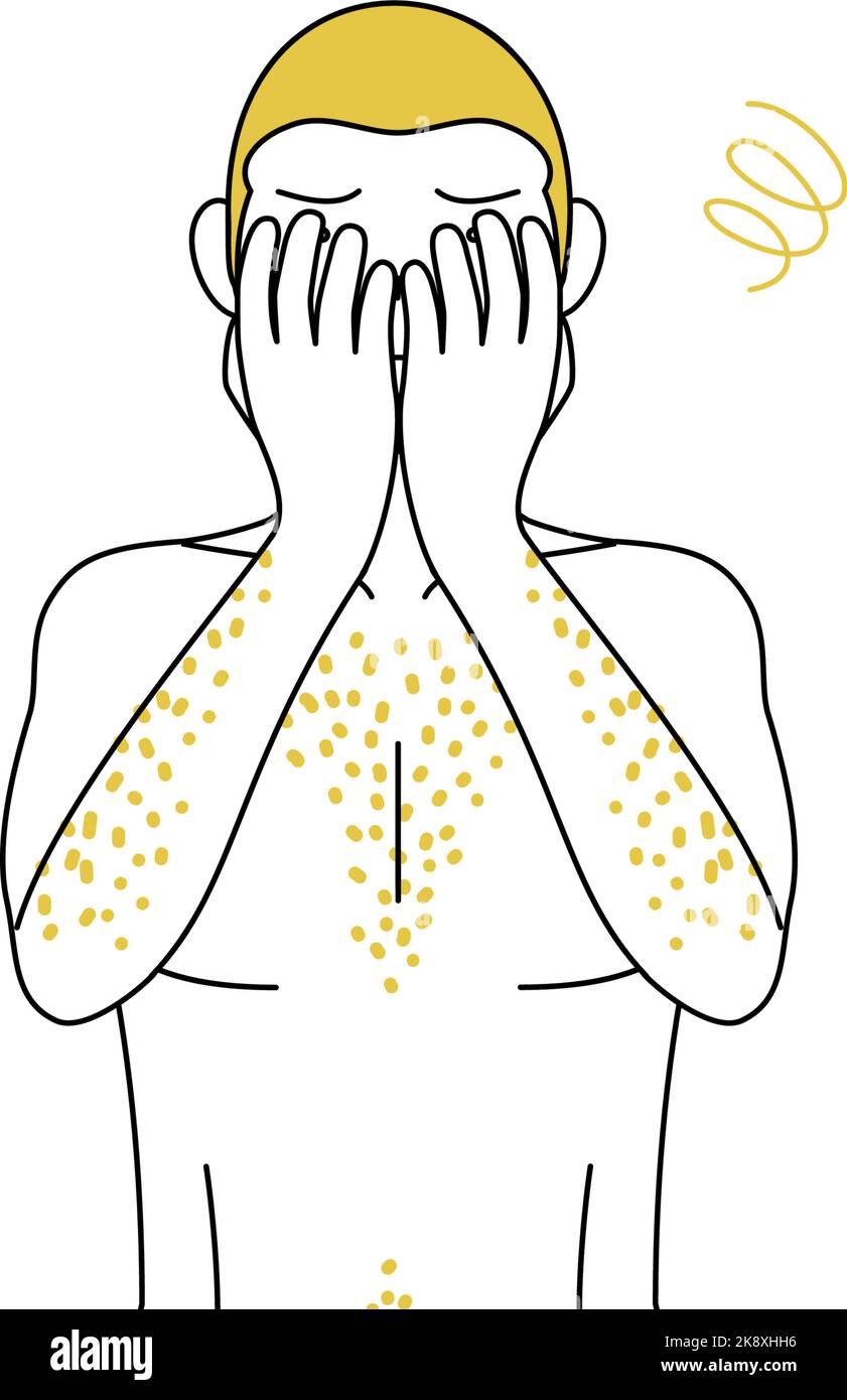 Line drawings of men suffering from thick body hair, pose of depression ...