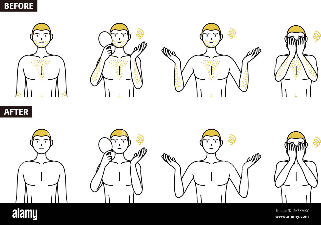 Set of line drawing poses of a man suffering from thick body hair ...