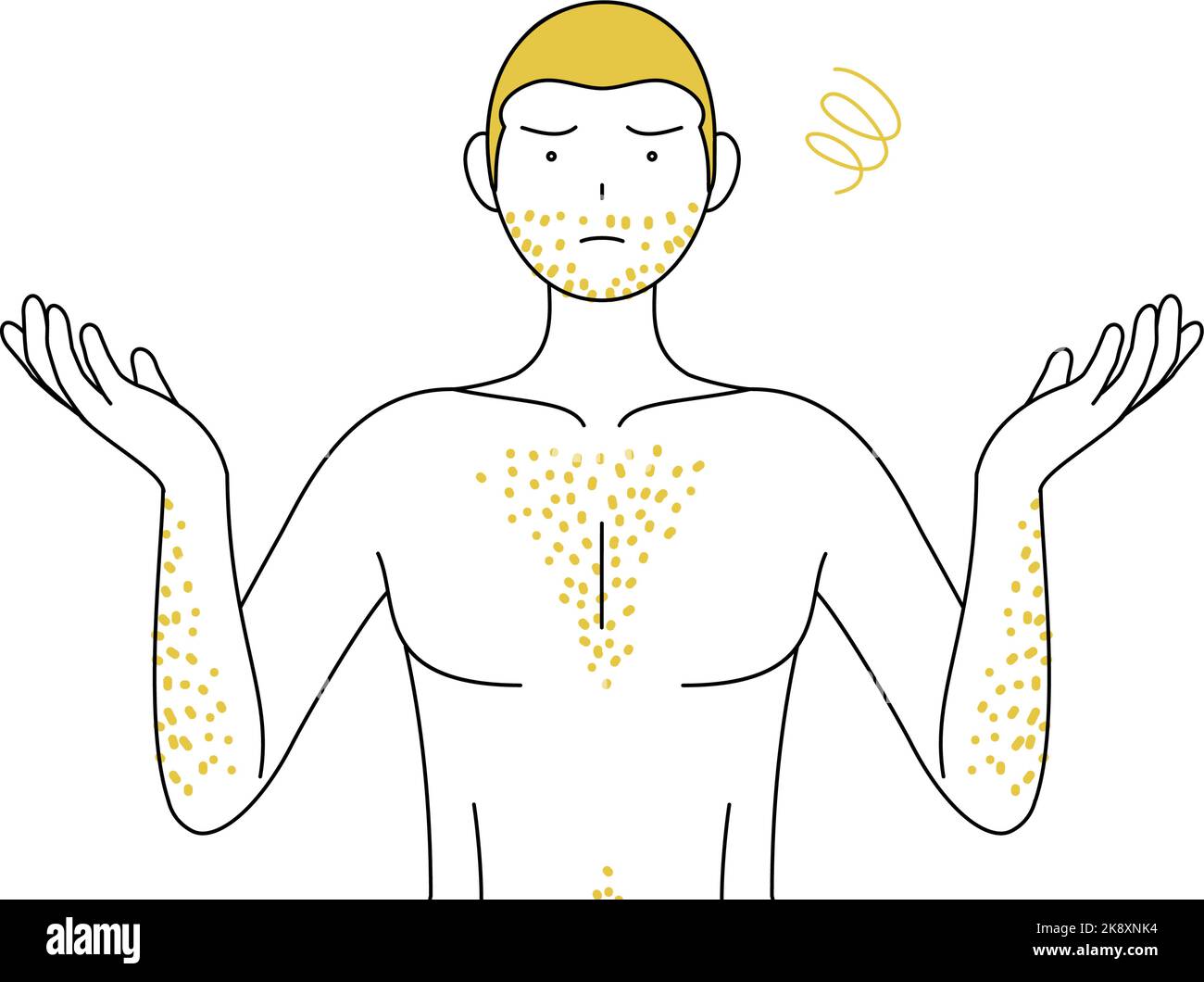 Line drawings of men suffering from thick body hair, pose with arms ...