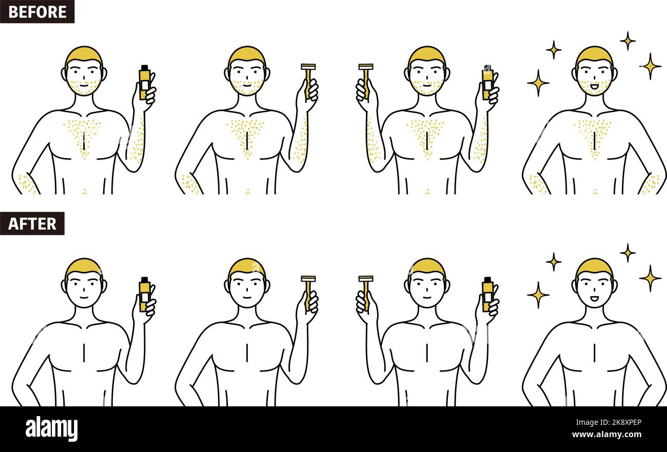 Set of line drawing poses of a man suffering from thick body hair ...