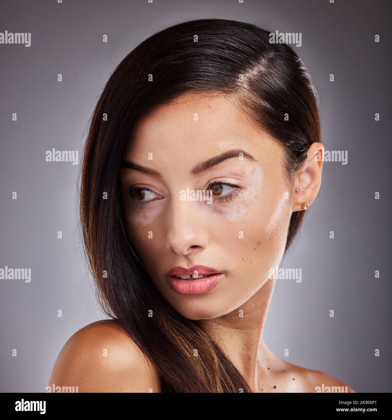 Beauty, face and vitiligo with a model woman in studio on a gray ...