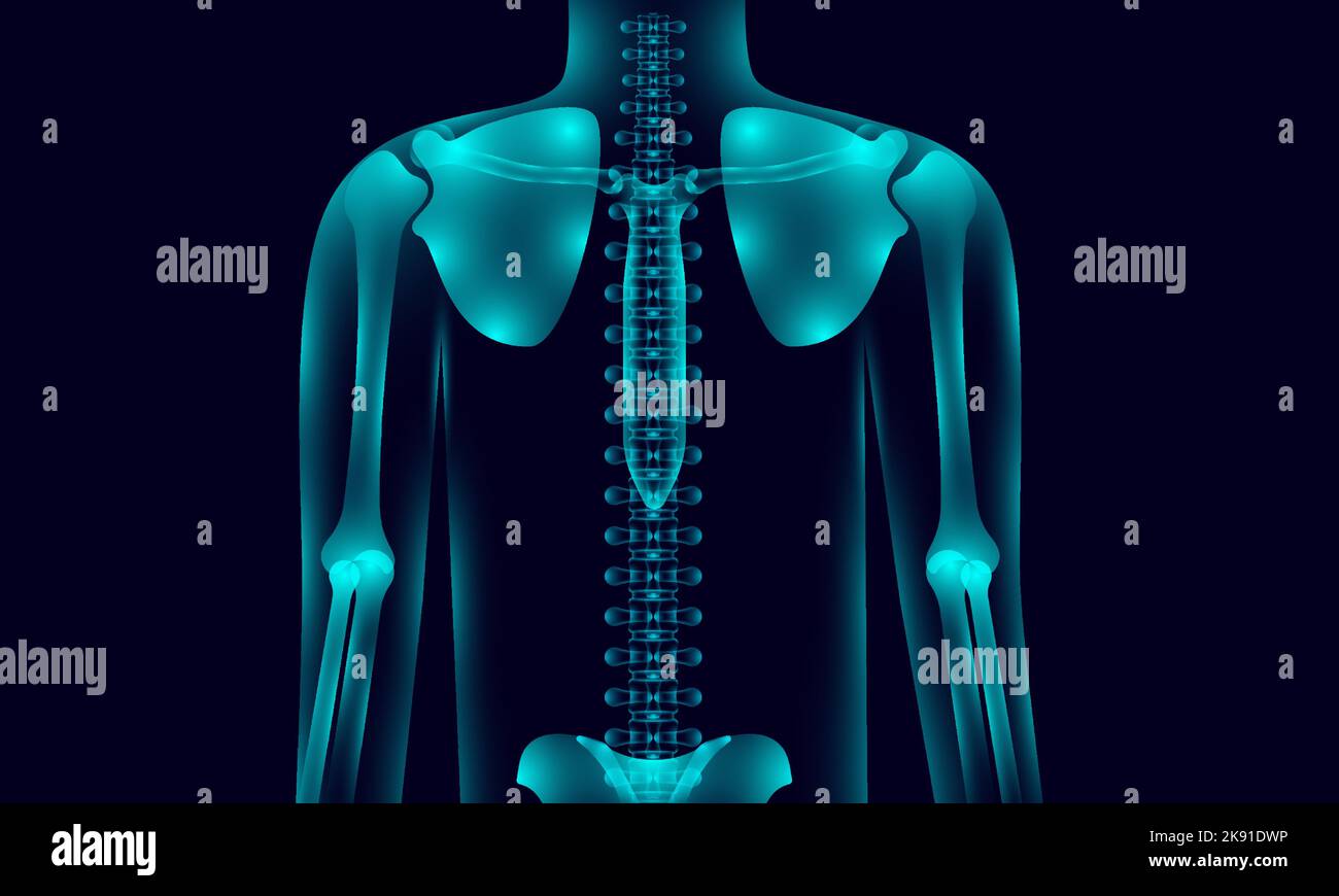 An X-ray image of a human skeleton Stock Vector Image & Art - Alamy