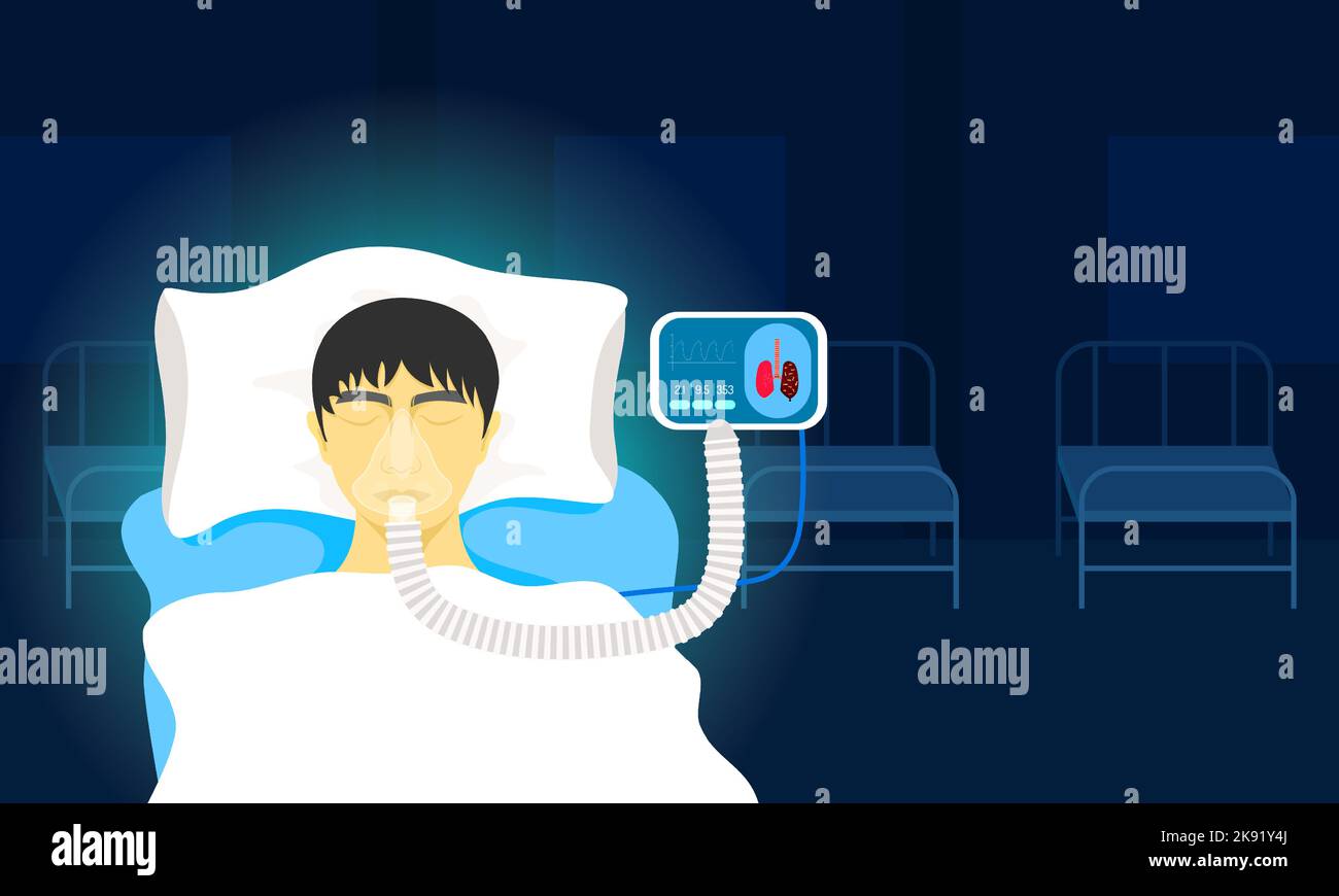 A vector of a lung cancer patient sleeping on the bed in the hospital ...