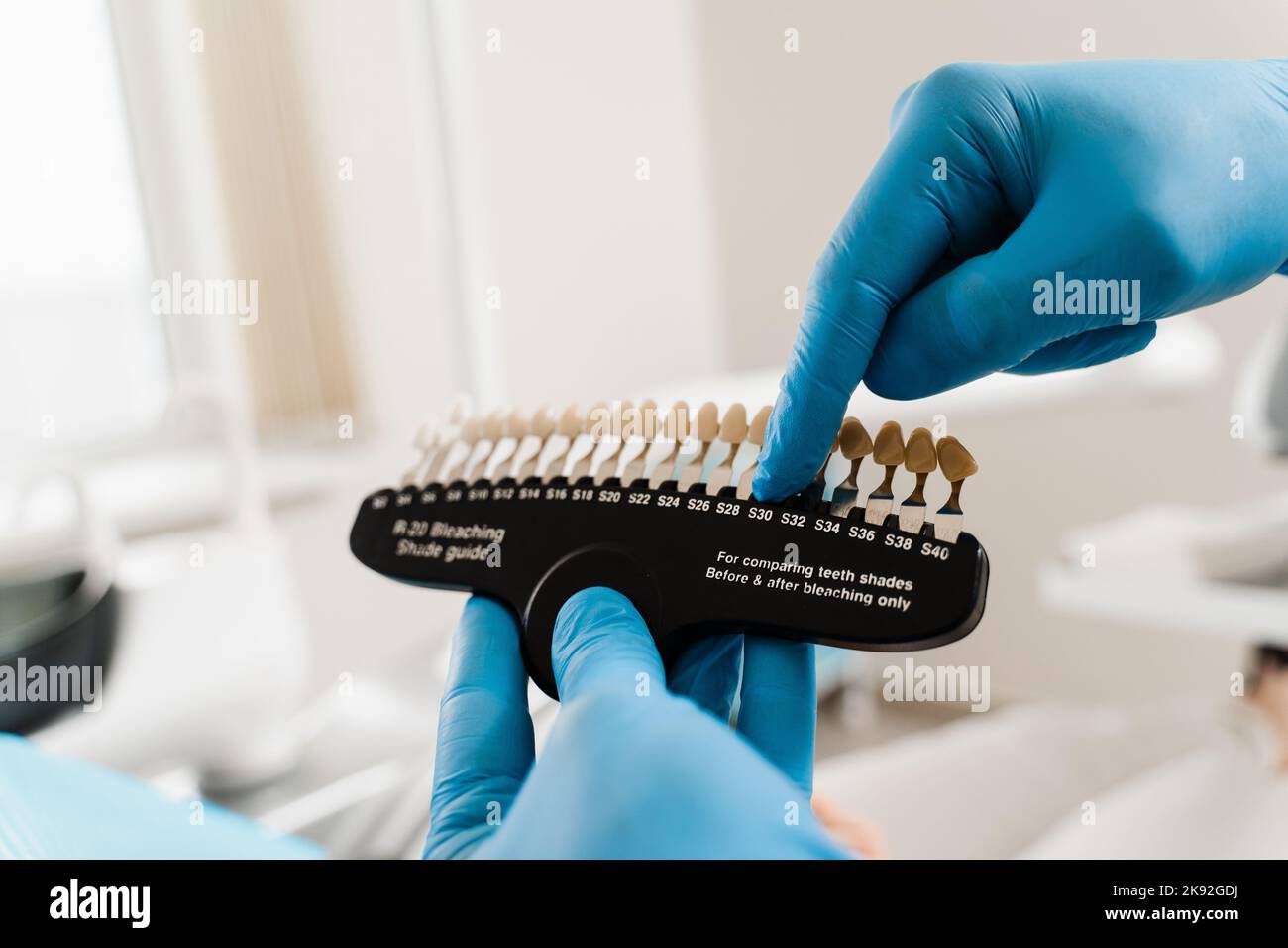 Teeth color shades guide close-up. Dentistry. Veneers or implants teeth ...