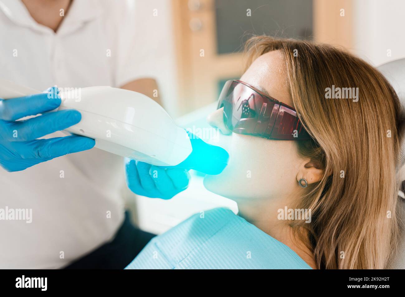 Artificial teeth whitening. Dental ultraviolet whitening treatment with ...