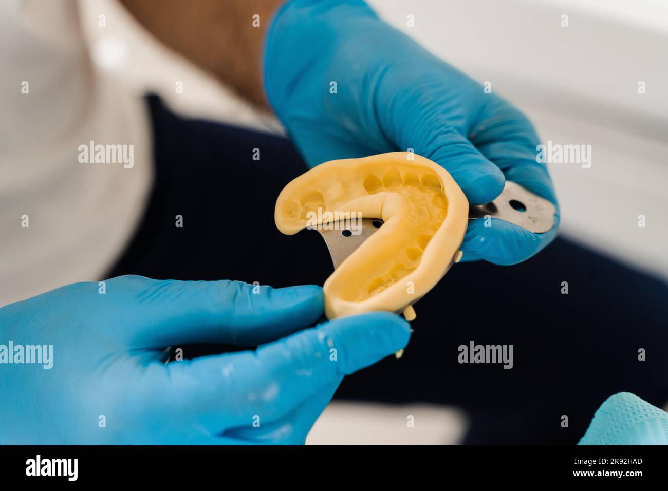 Dental cast of teeth of jaw close-up. Visiting dentist before dental ...