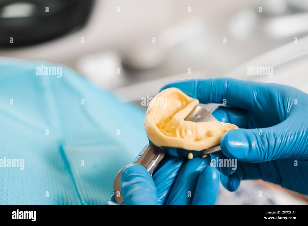 Dental cast of teeth of jaw close-up. Visiting dentist before dental ...