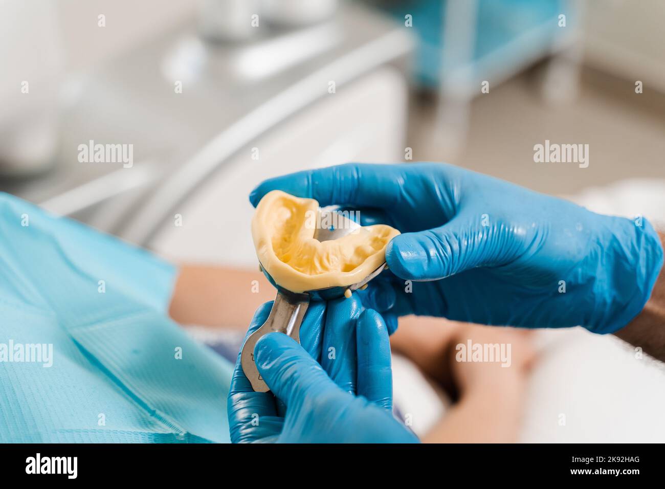Dental cast of teeth of jaw close-up. Visiting dentist before dental ...