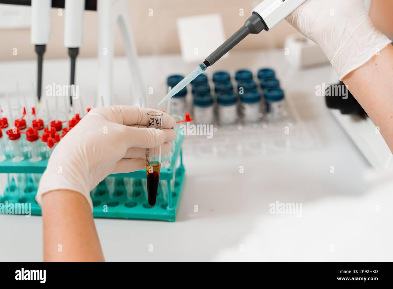 Using microdoser for blood analysis and test in laboratory. Medical ...