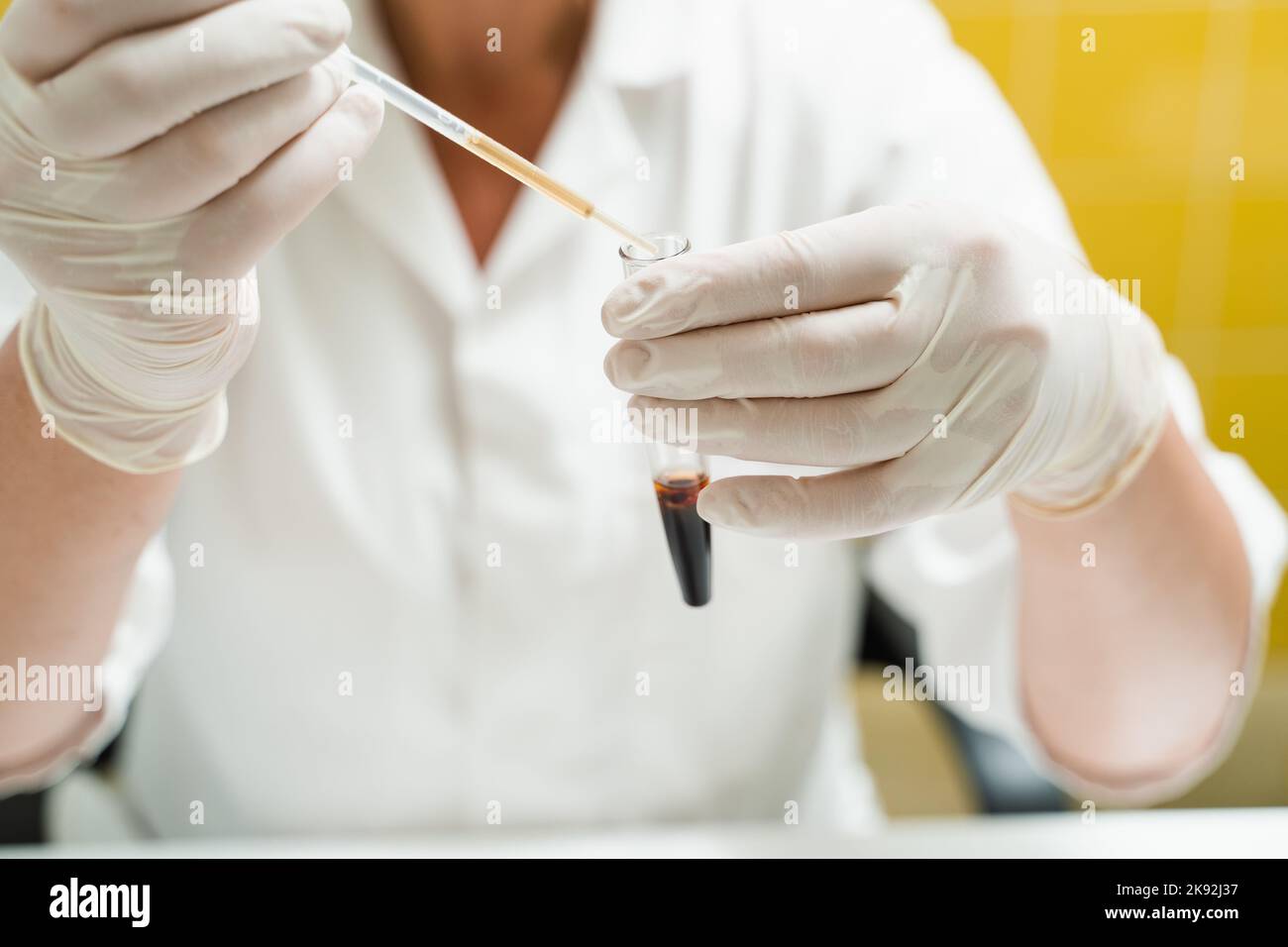 Analysis of blood plasma close-up. Laboratory assistant hold test tube ...