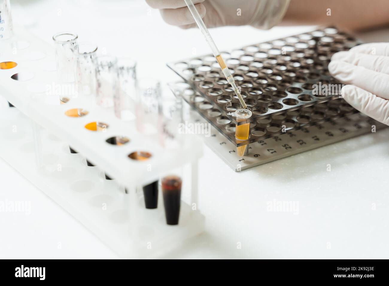 Analysis of blood plasma close-up. Laboratory assistant hold test tube ...
