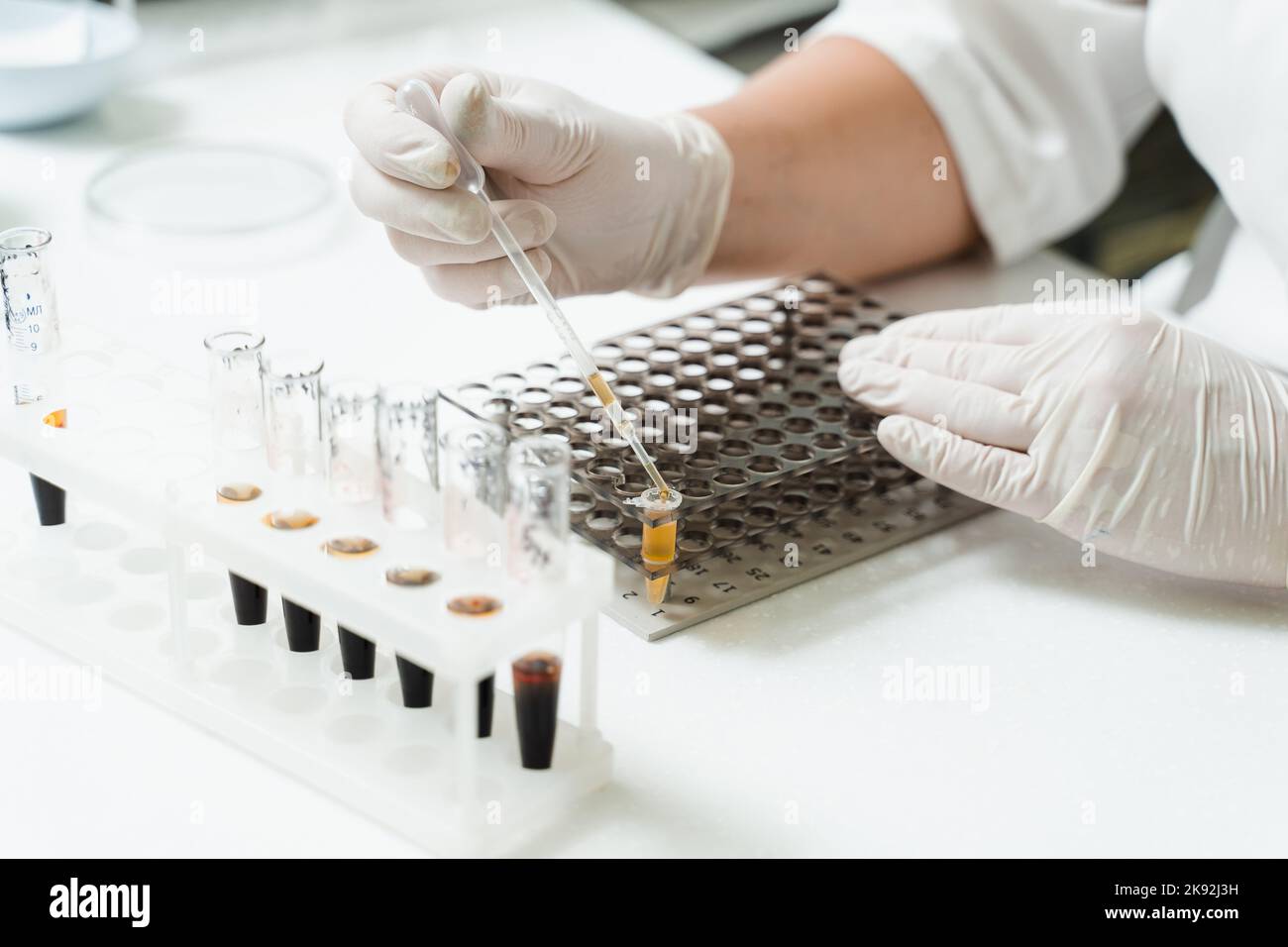 Analysis of blood plasma close-up. Laboratory assistant hold test tube ...