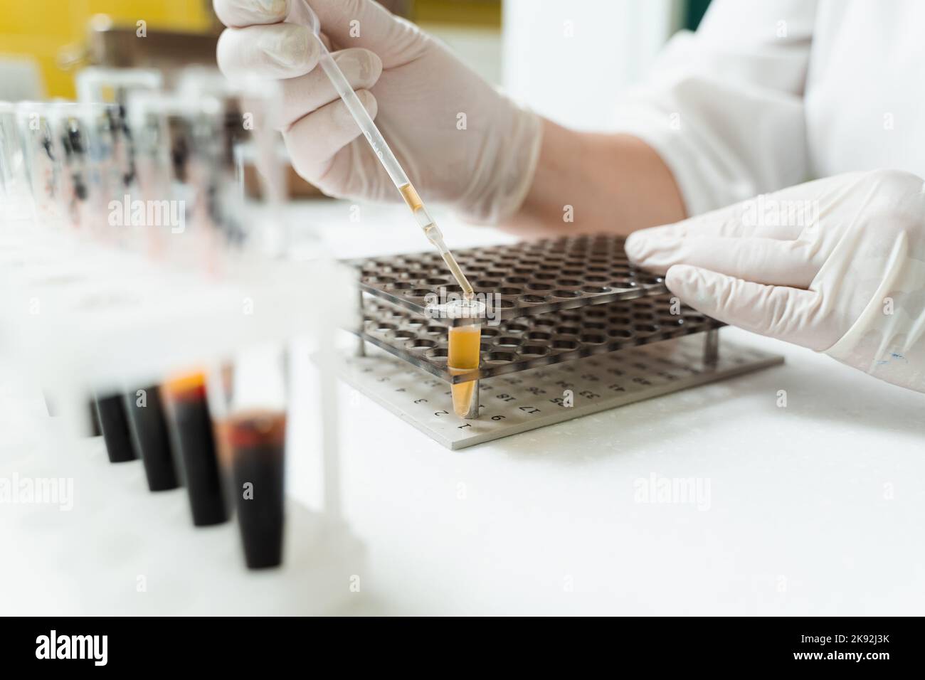 Analysis of blood plasma close-up. Laboratory assistant hold test tube ...