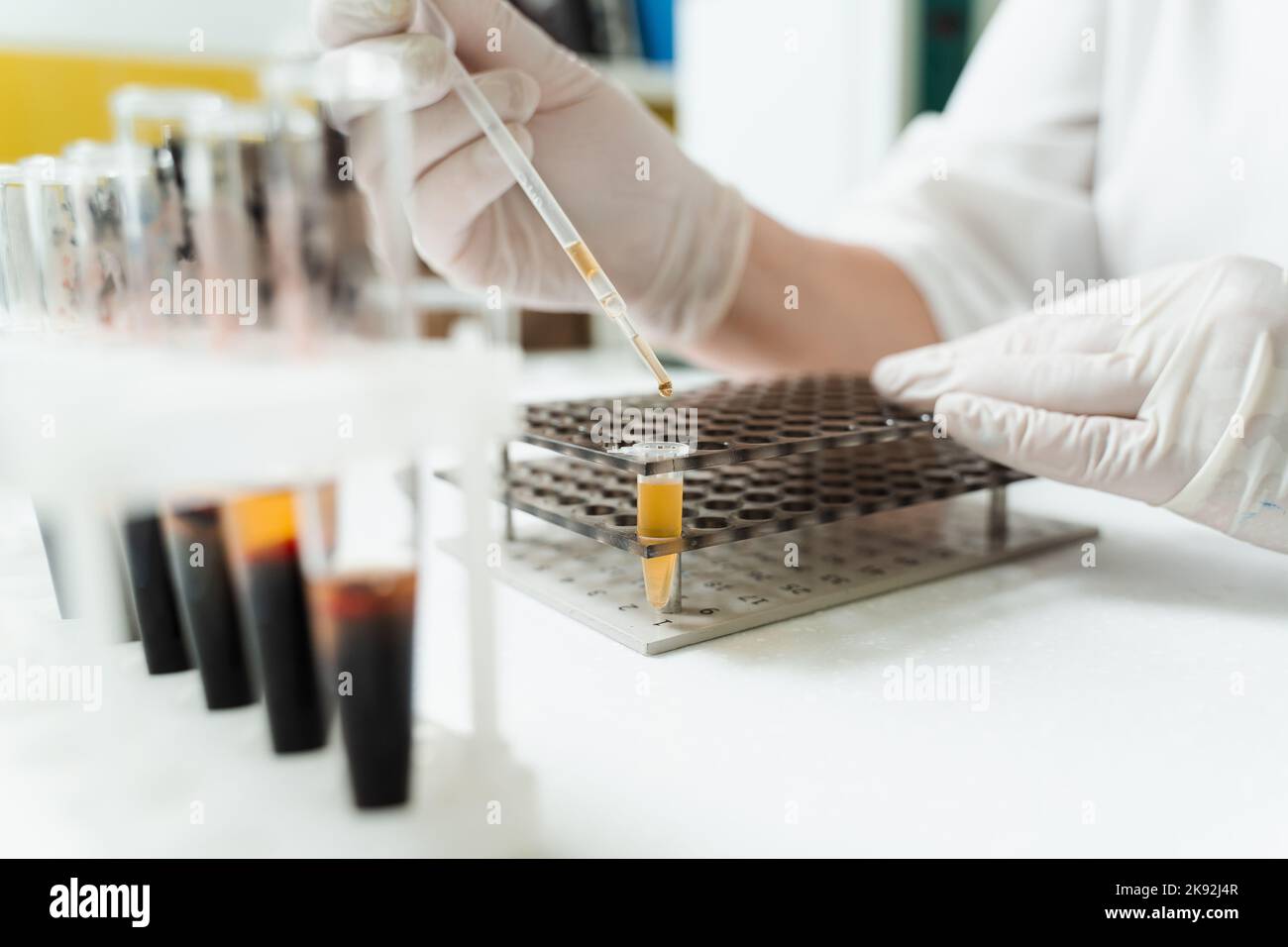 Analysis of blood plasma close-up. Laboratory assistant hold test tube ...