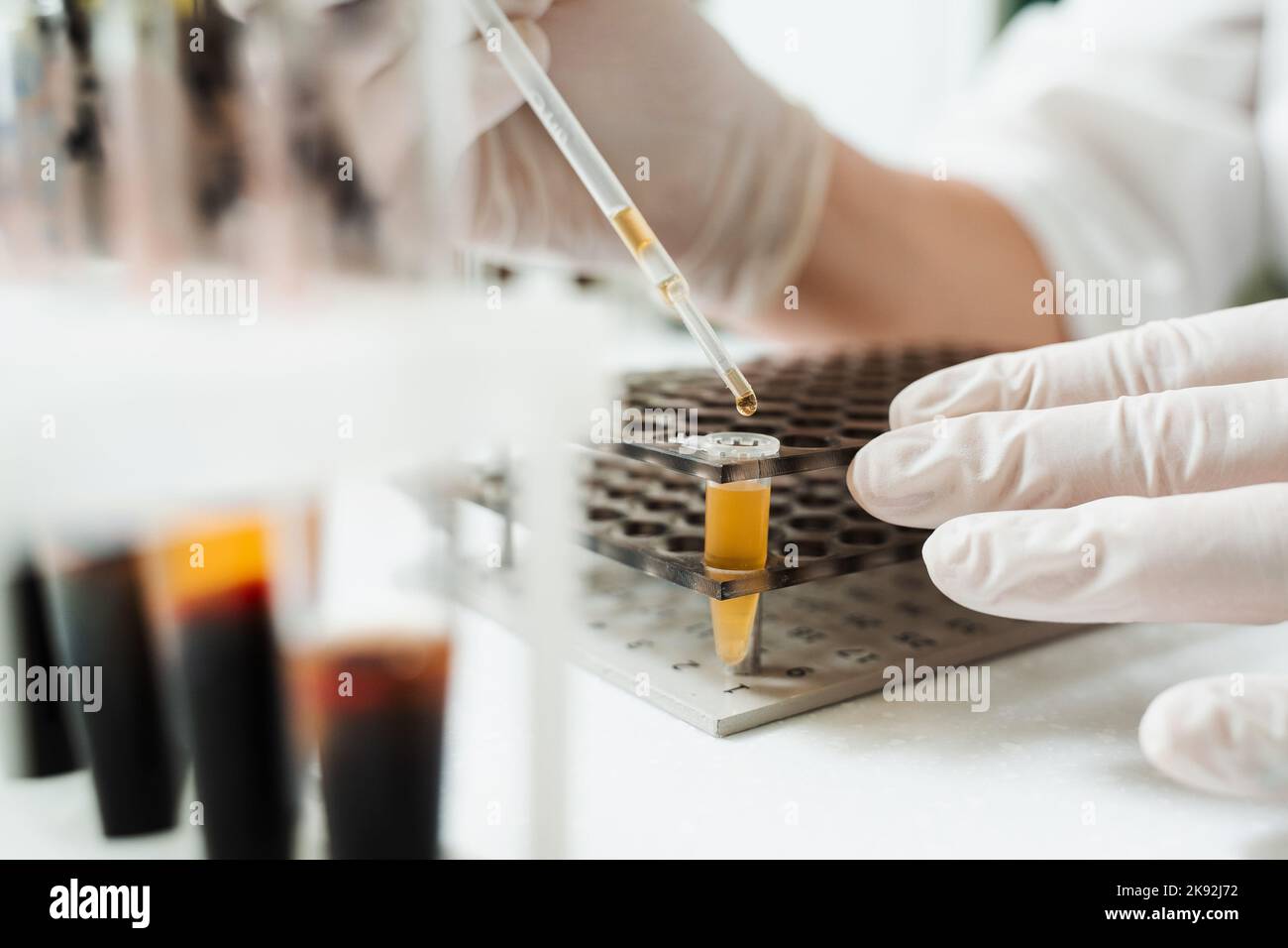 Analysis of blood plasma close-up. Laboratory assistant hold test tube ...