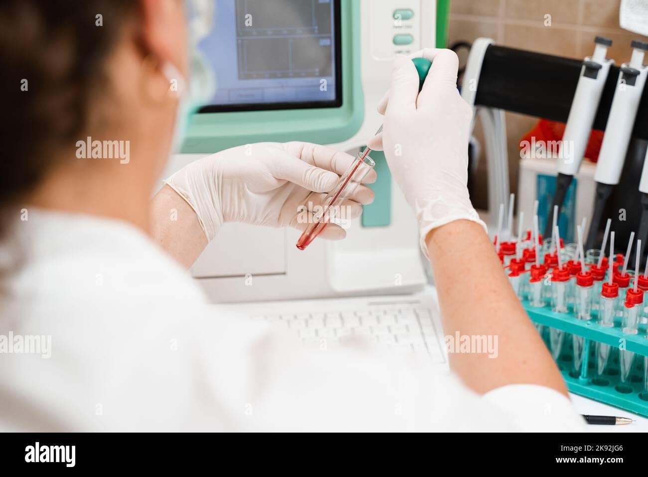 Laboratory assistant works on blood analyzer and makes hematological ...