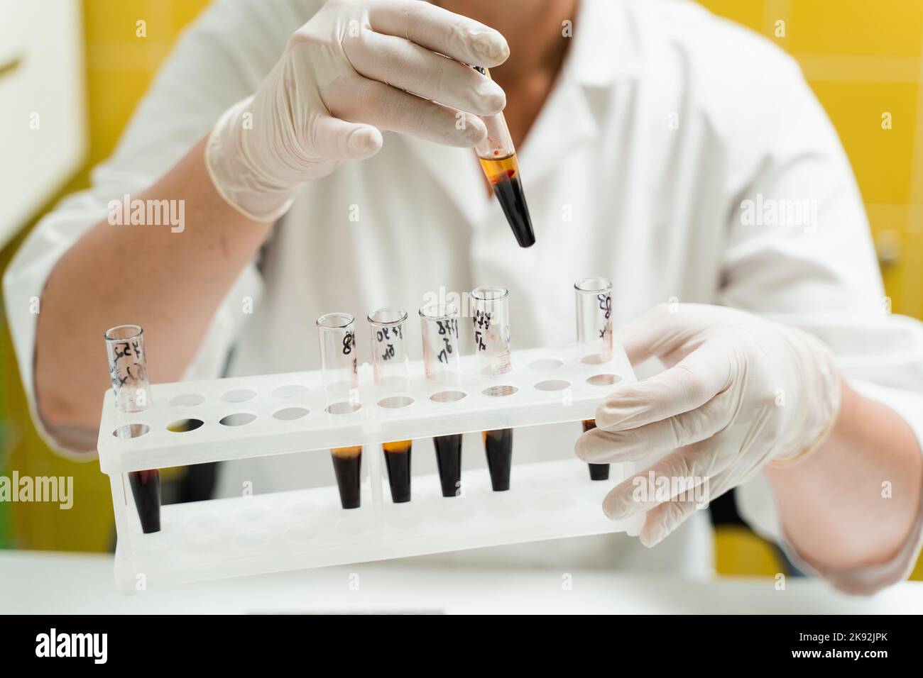 Analysis of blood plasma. The laboratory assistant holds a test tube ...